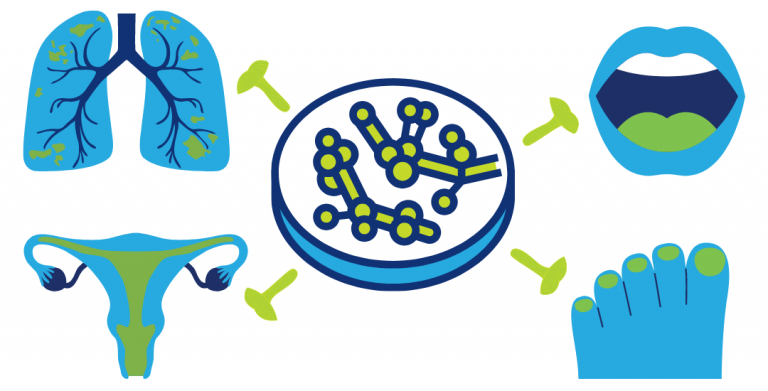 When Fungal Infections Turn Deadly - One Health Trust